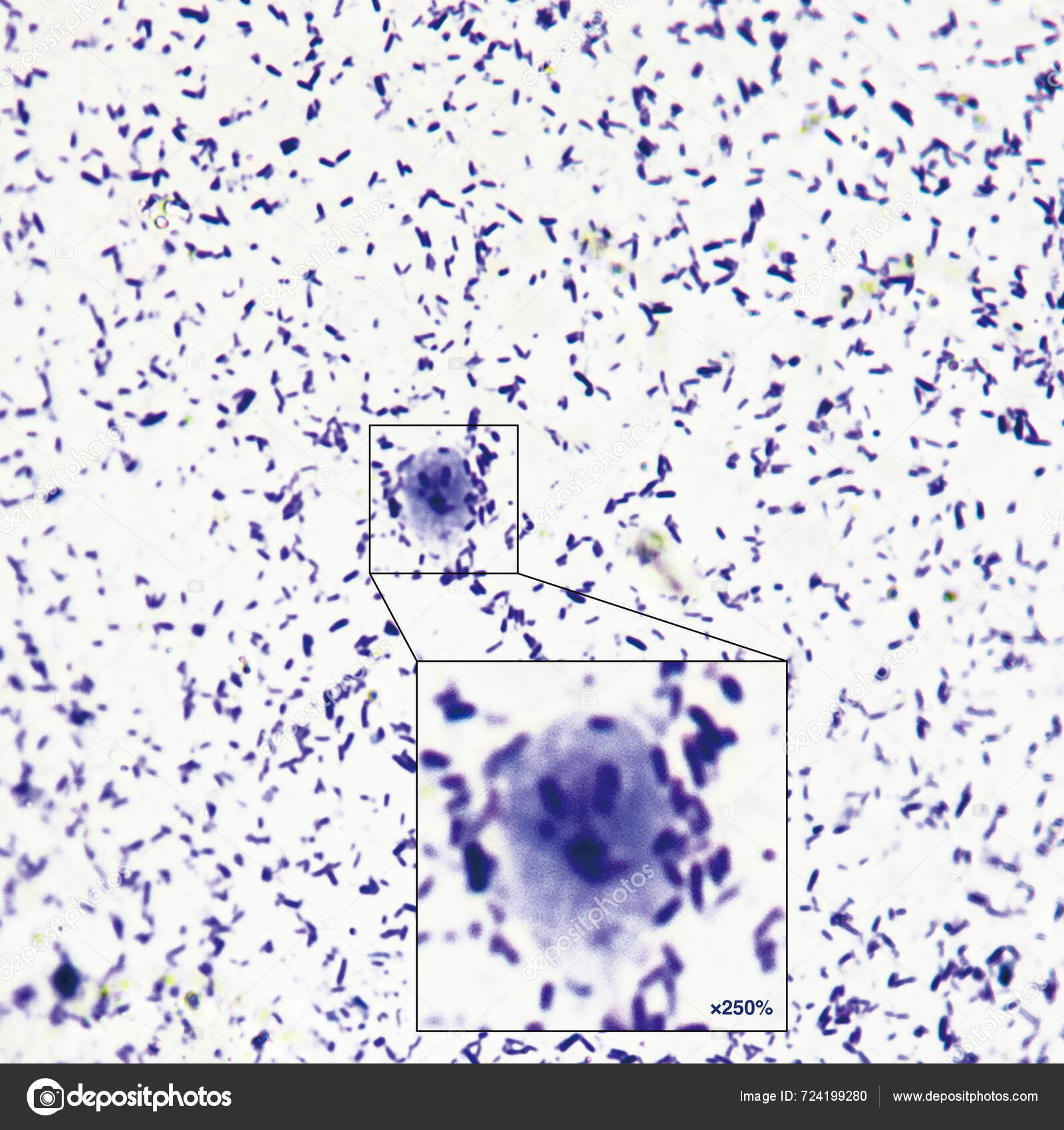 Giardia Parasitic Disease Caused Giardia Duodenalis Patients Have ...