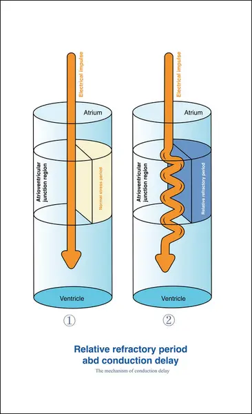 Nodo sinusal anatomia Stock Photos, Royalty Free Nodo sinusal anatomia ...