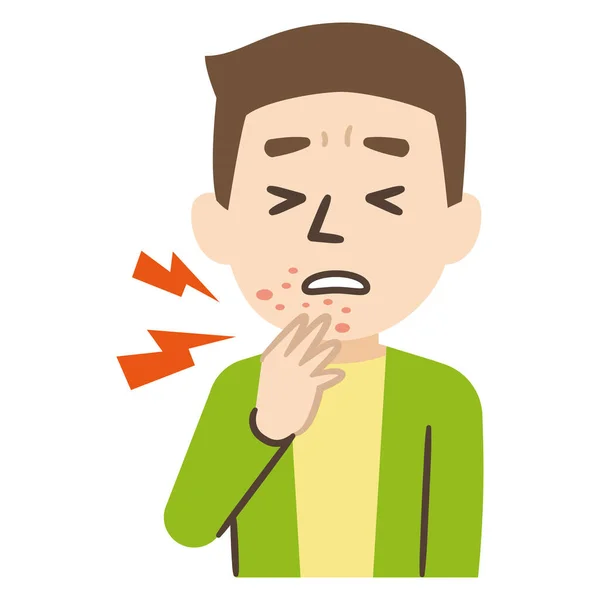 Vector Illustration Symptoms Shingles Stock Vector by ©ankomando 690910948