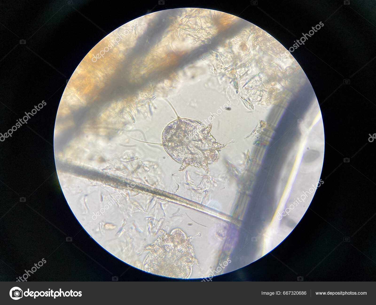 Scabies Eggs Under Microscope