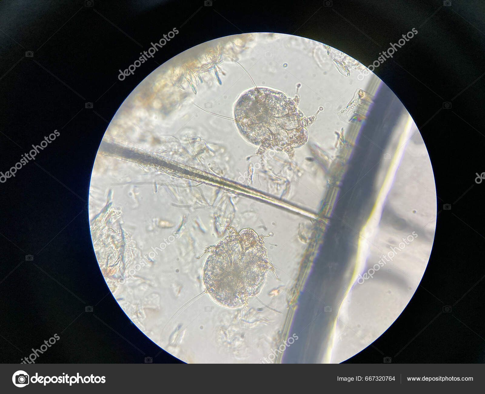 Scabies Under Microscope