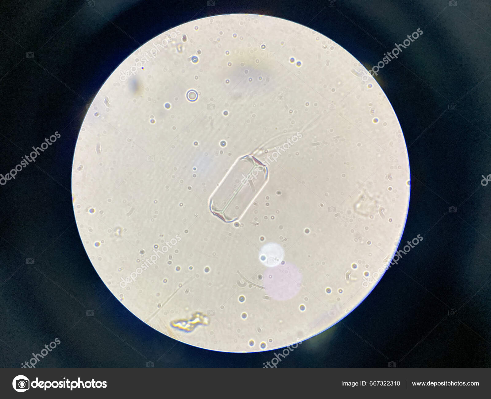 Magnesium Phosphate Crystals