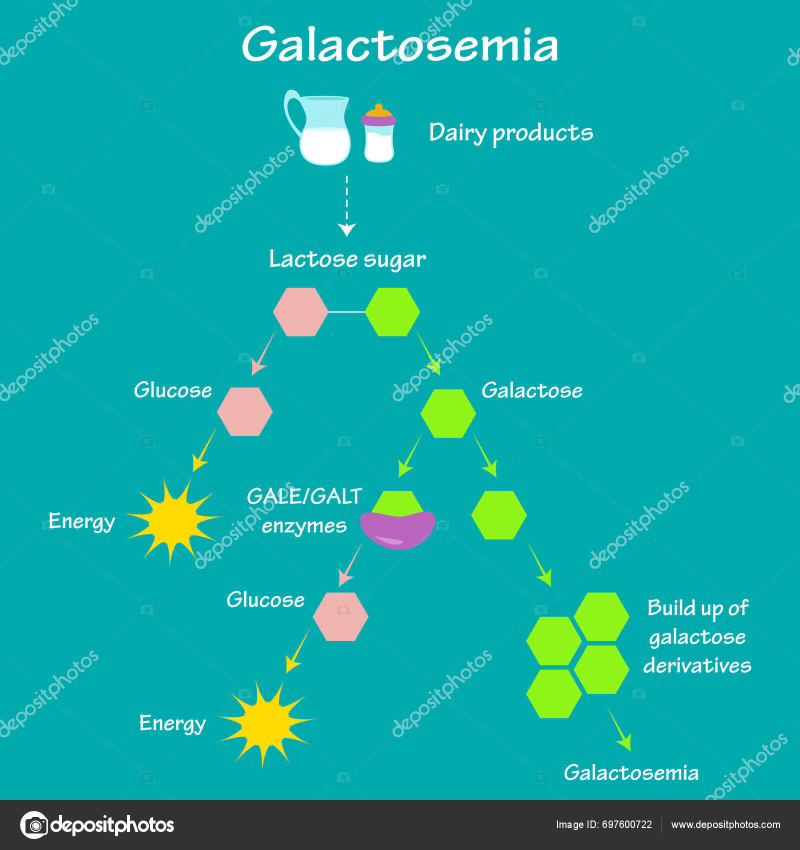 Galactosemia Gale Galk Galt Enzymatic Deficiency Science Vector ...
