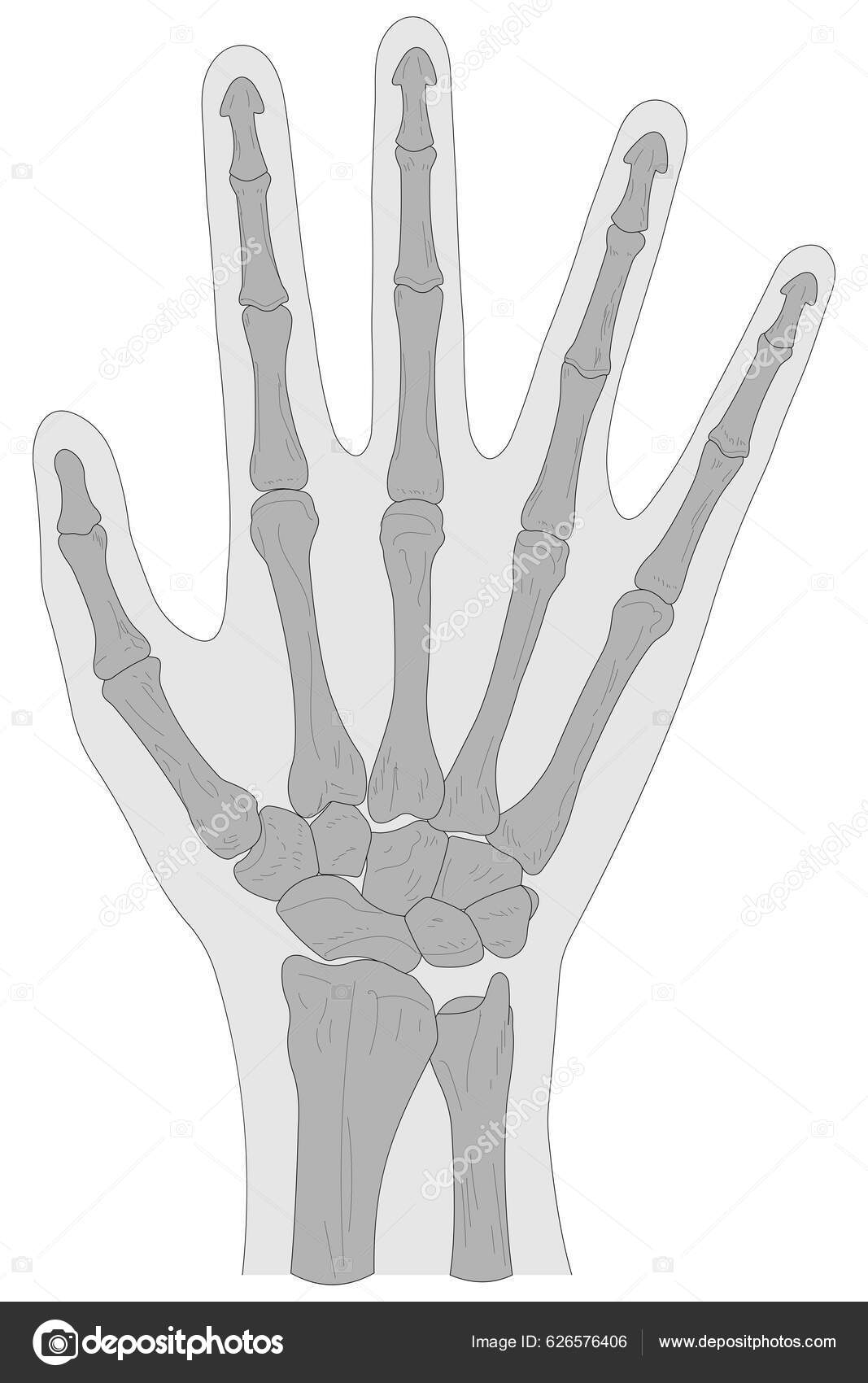 Huesos Mano Derecha Vista Dorsal Posterior Vector de stock #626576406 ...
