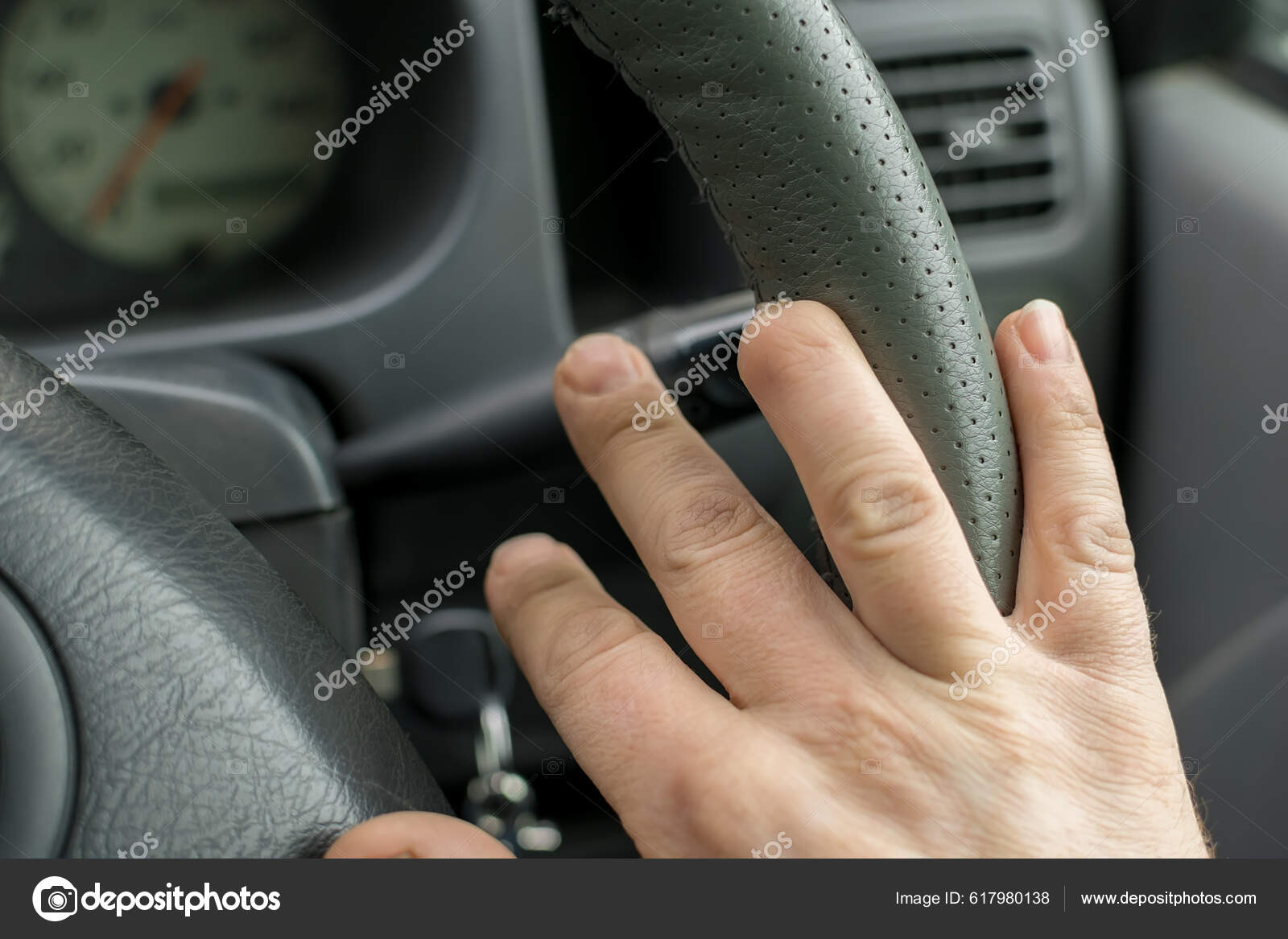Hand Man Missing Finger Phalanx — Stock Photo © YAY_Images #617980138
