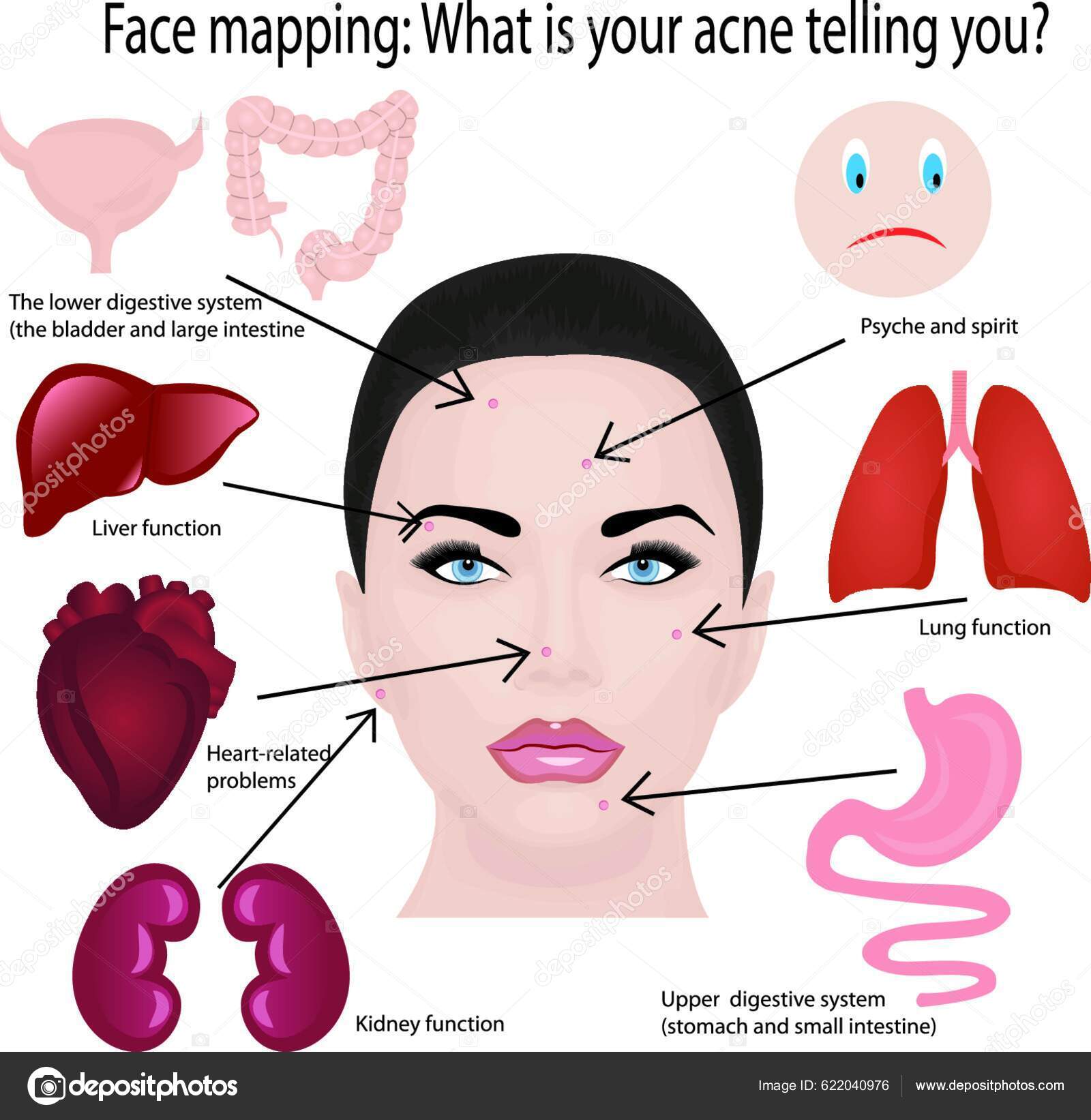 Face Mapping What Your Acne Telling You Info Graphic Stock Illustration ...