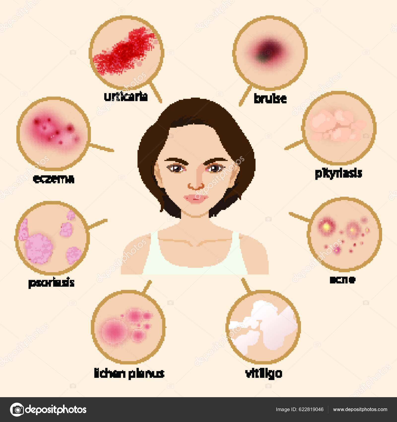 Diagramme Montrant Différentes Maladies Stock Vector by ©YAY_Images ...