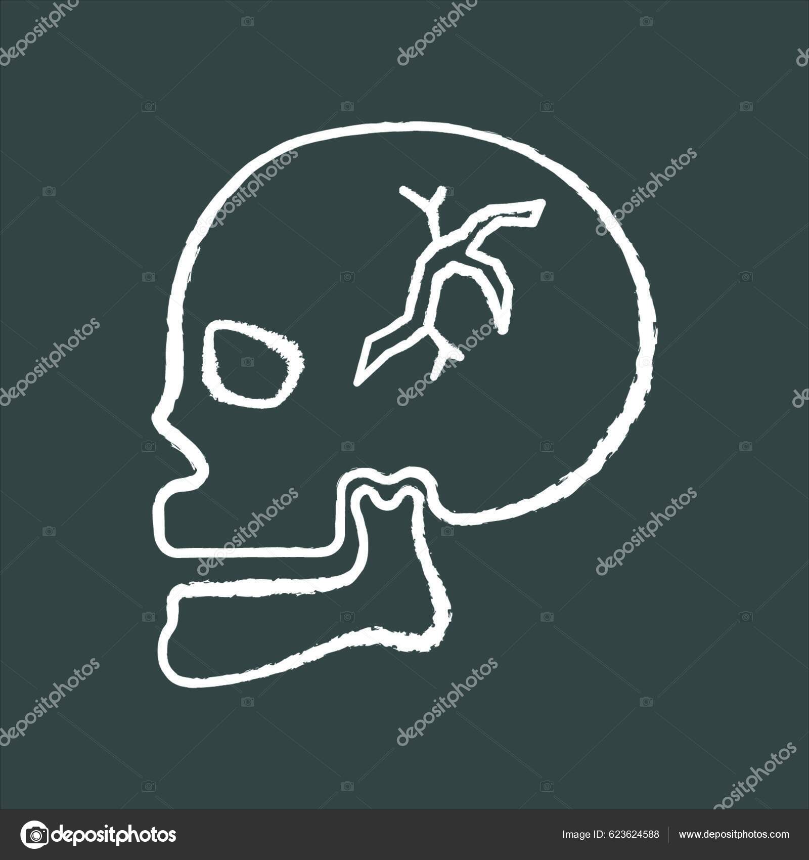 Skull Fracture Chalk White Icon Black Background Cranial Bone Break ...