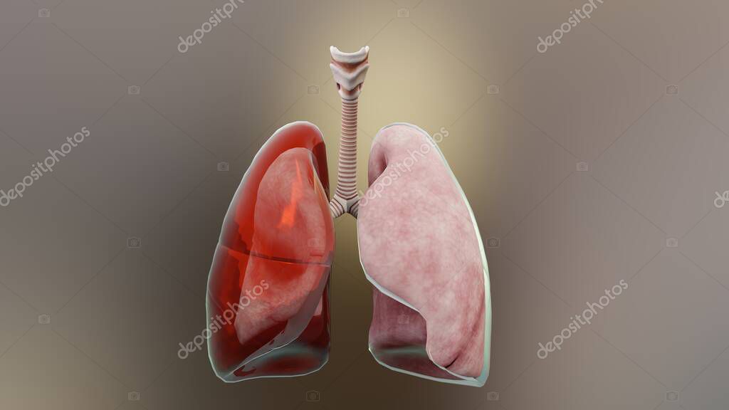 Ilustración 3d de hemotórax, pulmón normal versus colapsado, síntomas ...
