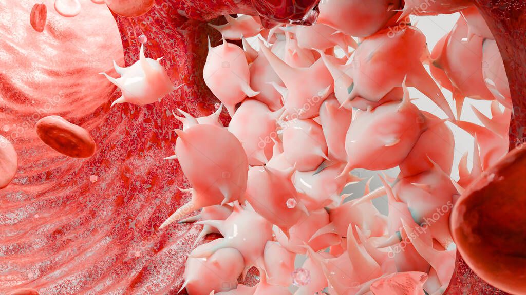 Hemostasia. Glóbulos rojos y plaquetas en el vaso sanguíneo ...