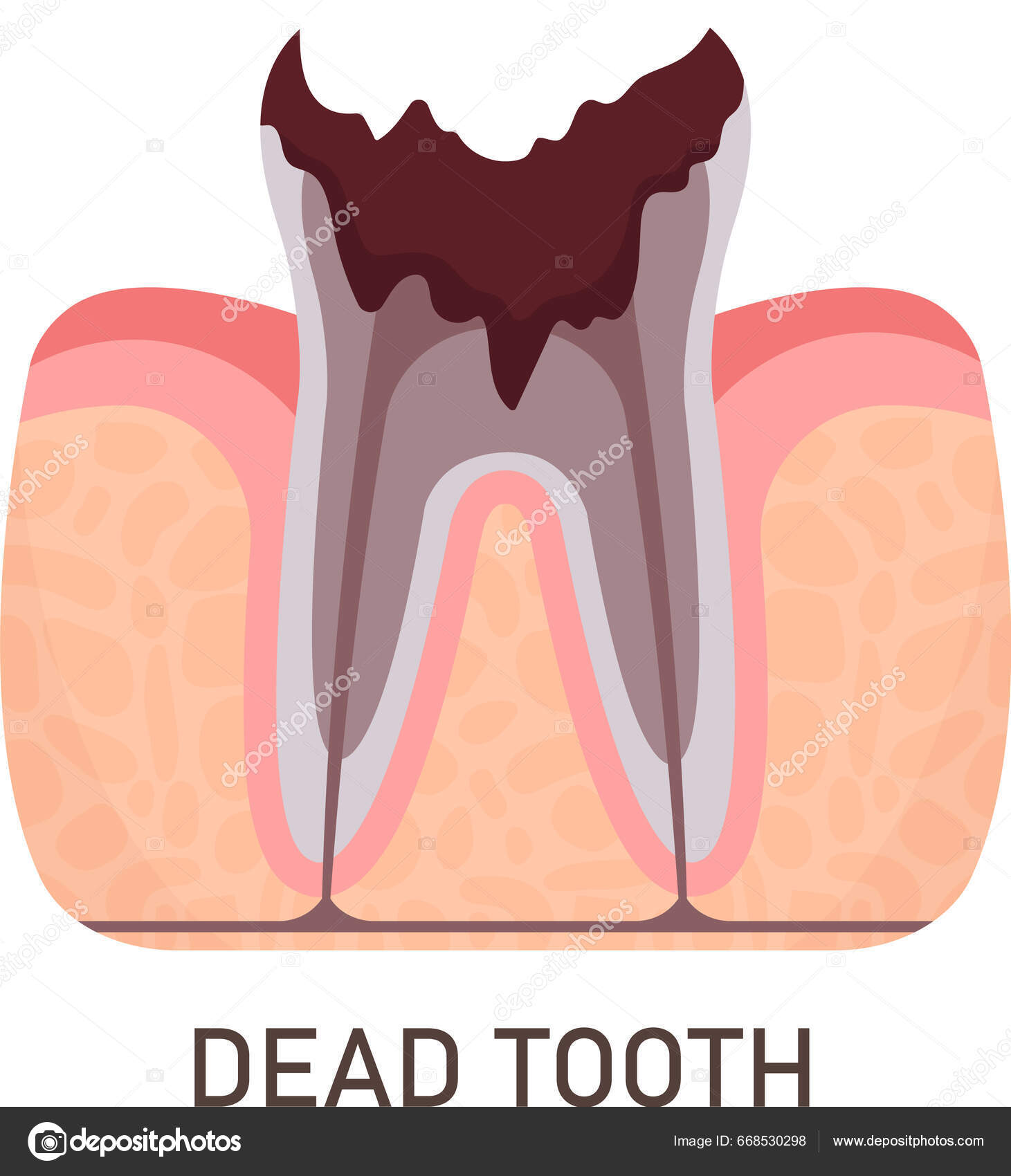 Diente Muerto Problema Vector Ilustración Vector de stock por ©Lookz ...