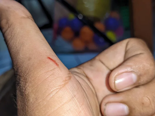 Dolor Stock Photos, Royalty Free Dolor Images | Depositphotos