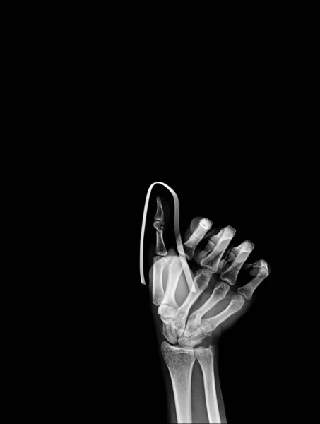 human hand with a skeleton on black background - Stock Image - Everypixel