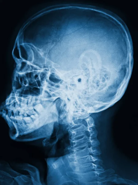 human anatomy x-ray image - Stock Image - Everypixel