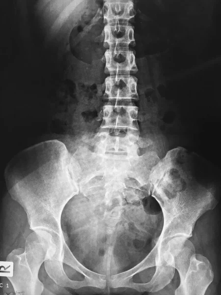 Radiography back Stock Photos, Royalty Free Radiography back Images ...