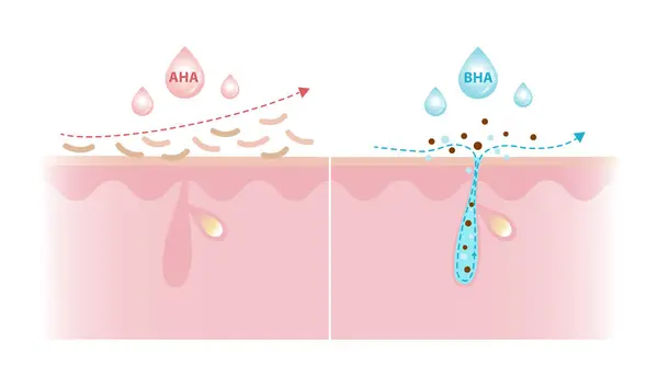 Chemical peel Vector Images | Depositphotos