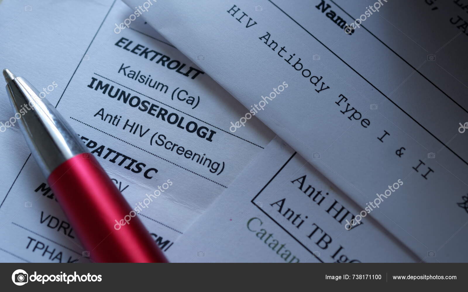 Medical Report Laboratory Test Results Hiv Types Tests Hiv — Stock ...