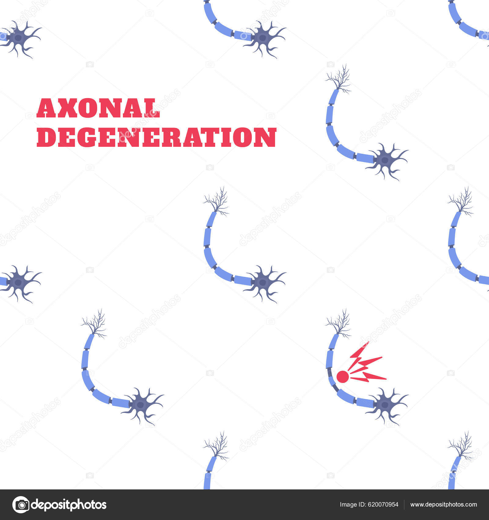 Axonal Nerve Degeneration Loss Communication Neurons Nad Disease ...