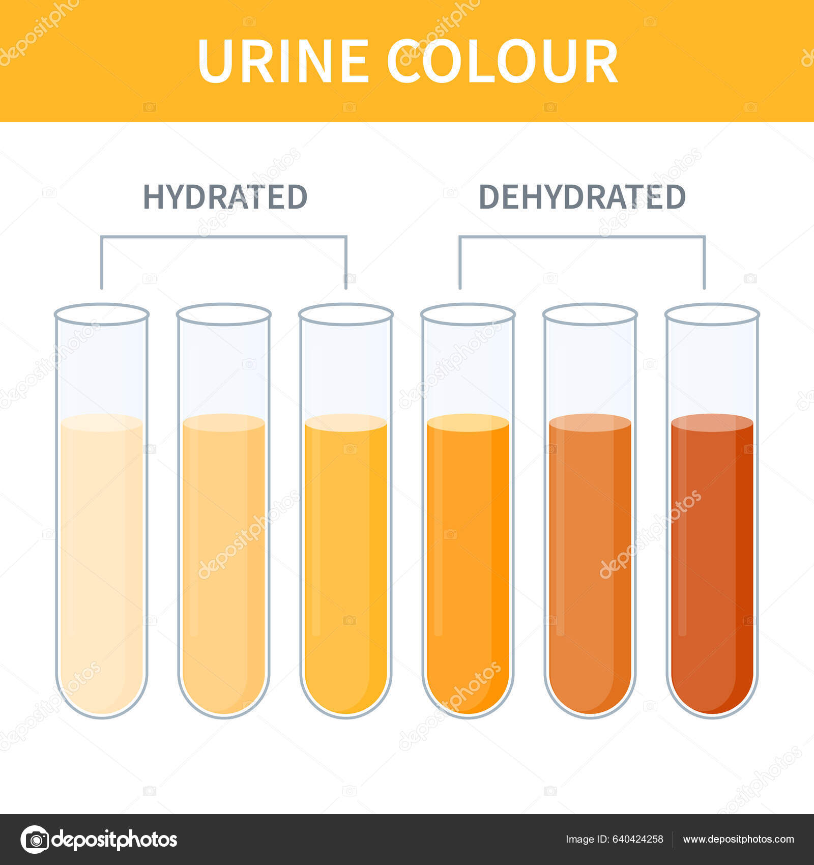 Urine Colour Chart Hydration Dehydration Level Diagram Medical Urinal ...