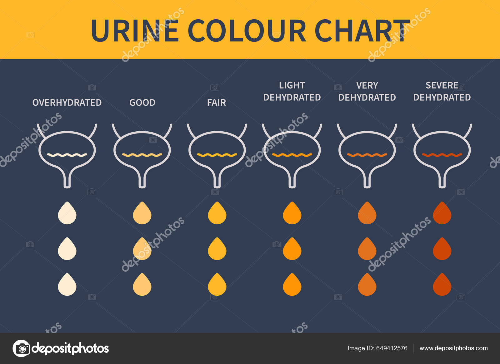 Diagramme Nuances D'urine Vessies Avec Gouttes D'urine Montrant Niveau ...