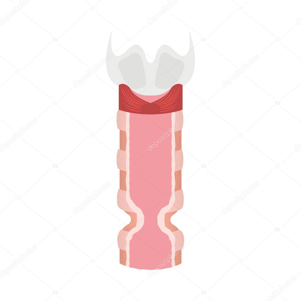 Ilustración de conciencia de estenosis traqueal. Traquea estrechamiento ...