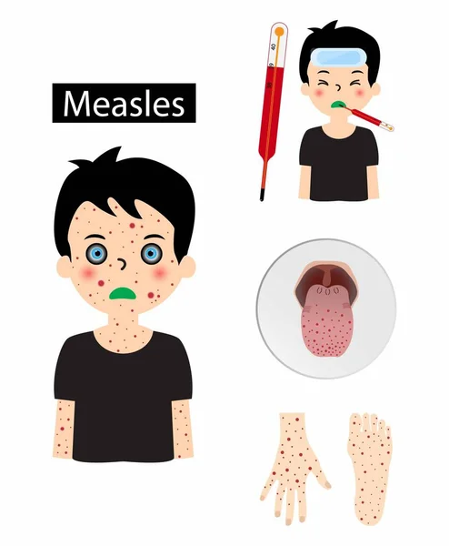Measles psd Stock Photos, Royalty Free Measles psd Images | Depositphotos