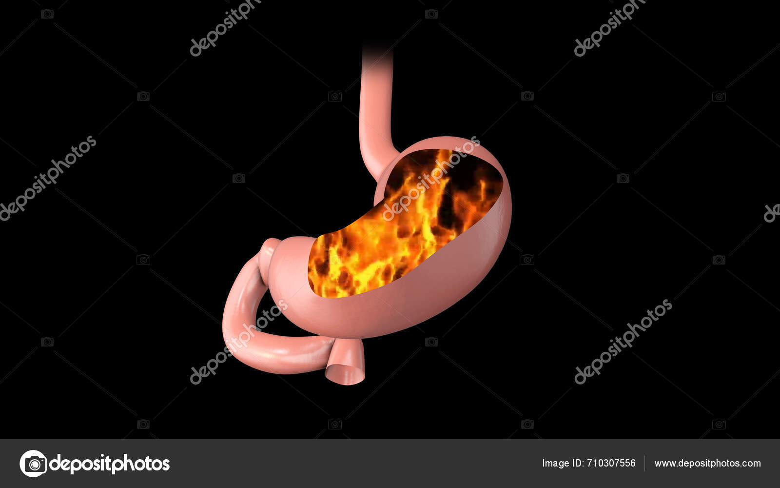 Stomach Ache Burning Sensation — Stock Photo © SilverPlace #710307556