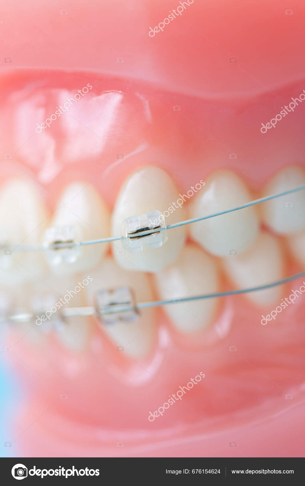 Fake Teeth Braces — Stock Photo © Paylessimages #676154624