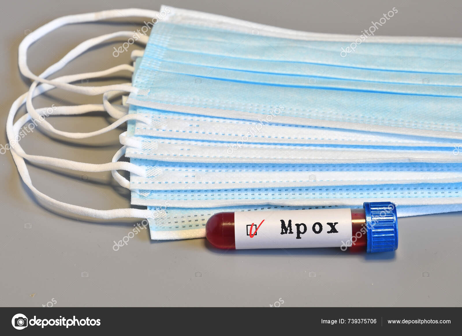 Blood Collection Tubes Monkeypox Mpox Face Mask Test Positive Results ...