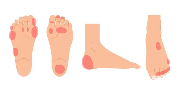 13,150,114 vectores de Forma del pie, imágenes vectoriales | Depositphotos
