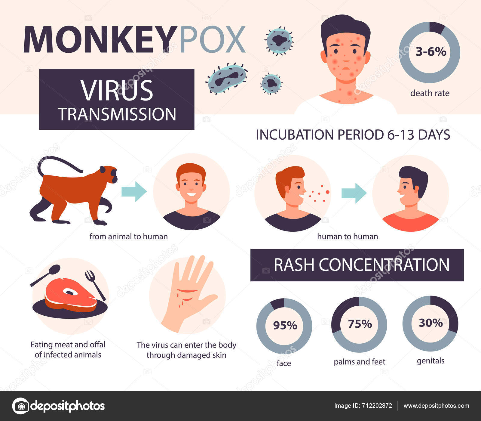 Infografis Cacar Monyet Infeksi Gejala Pencegahan Penyakit Cacar Monyet ...