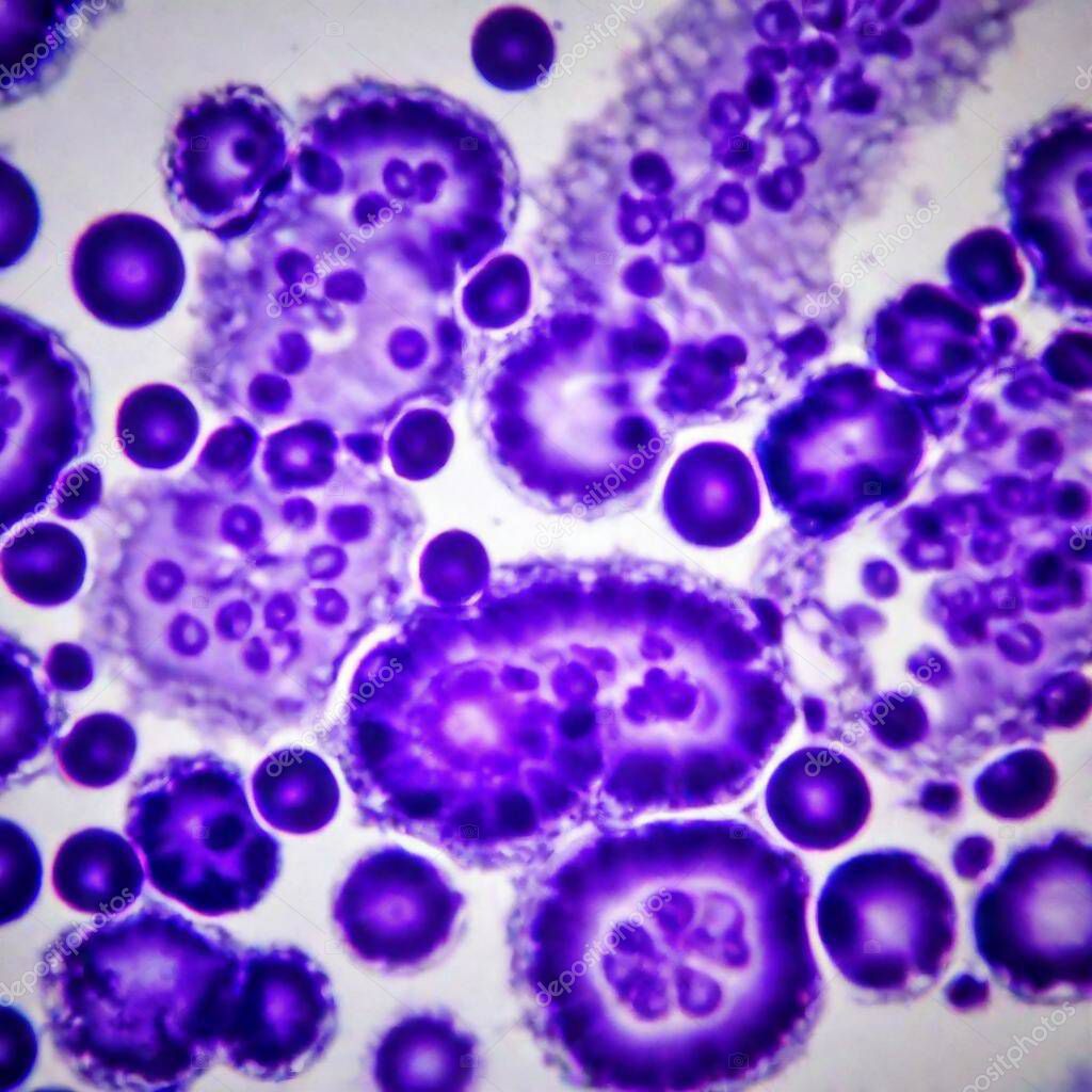 Dibuja el proceso a nivel celular. Reducción de la proliferación ...