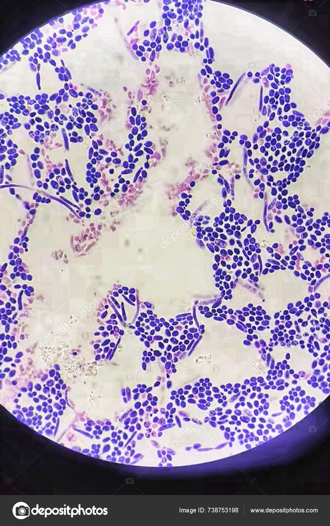 Branching Budding Yeast Cells Pseudohyphae Gram Stain Fine Light ...