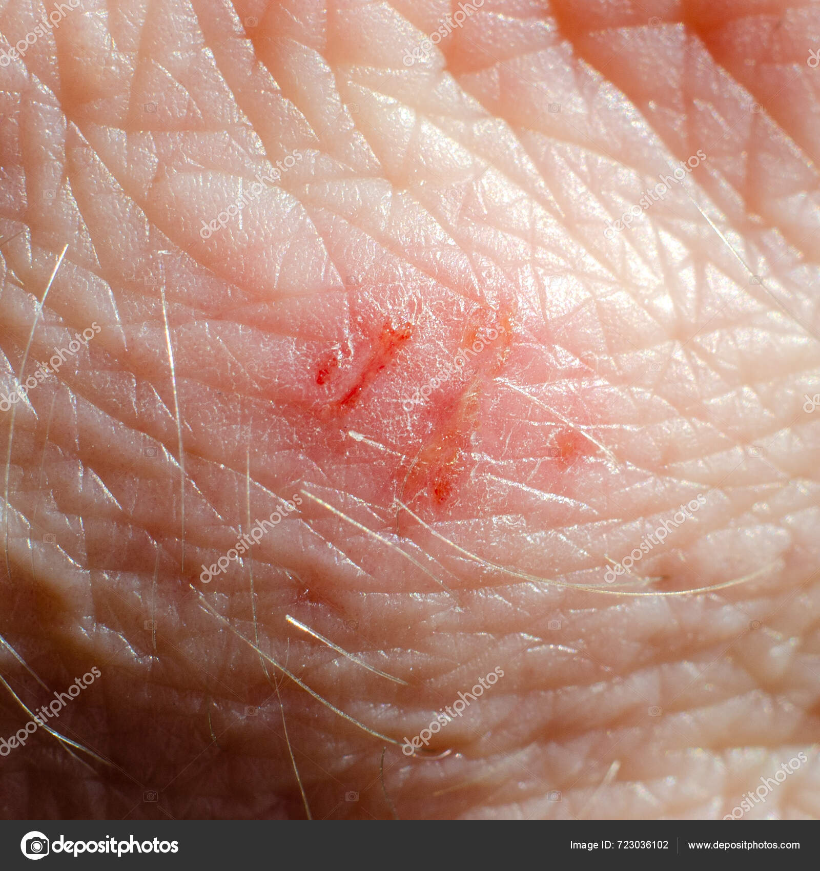 Close Wound Hand Adult — Stock Photo © dimas8308 #723036102