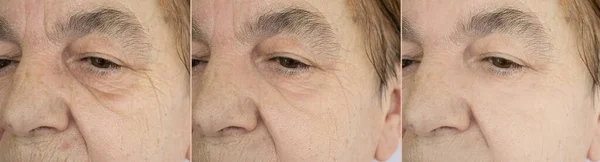 Visage ridé images libres de droit, photos de Visage ridé | Depositphotos